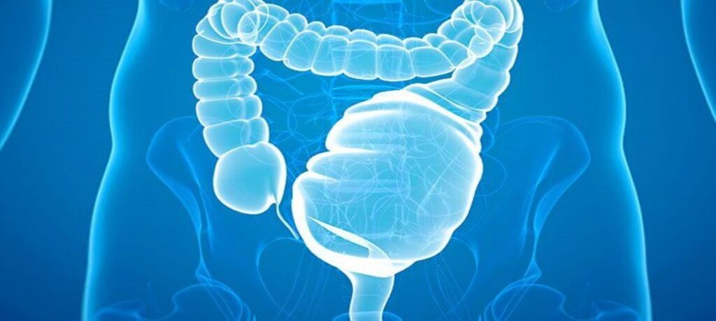 What is Ulcerative Colitis - International Gastro Institute